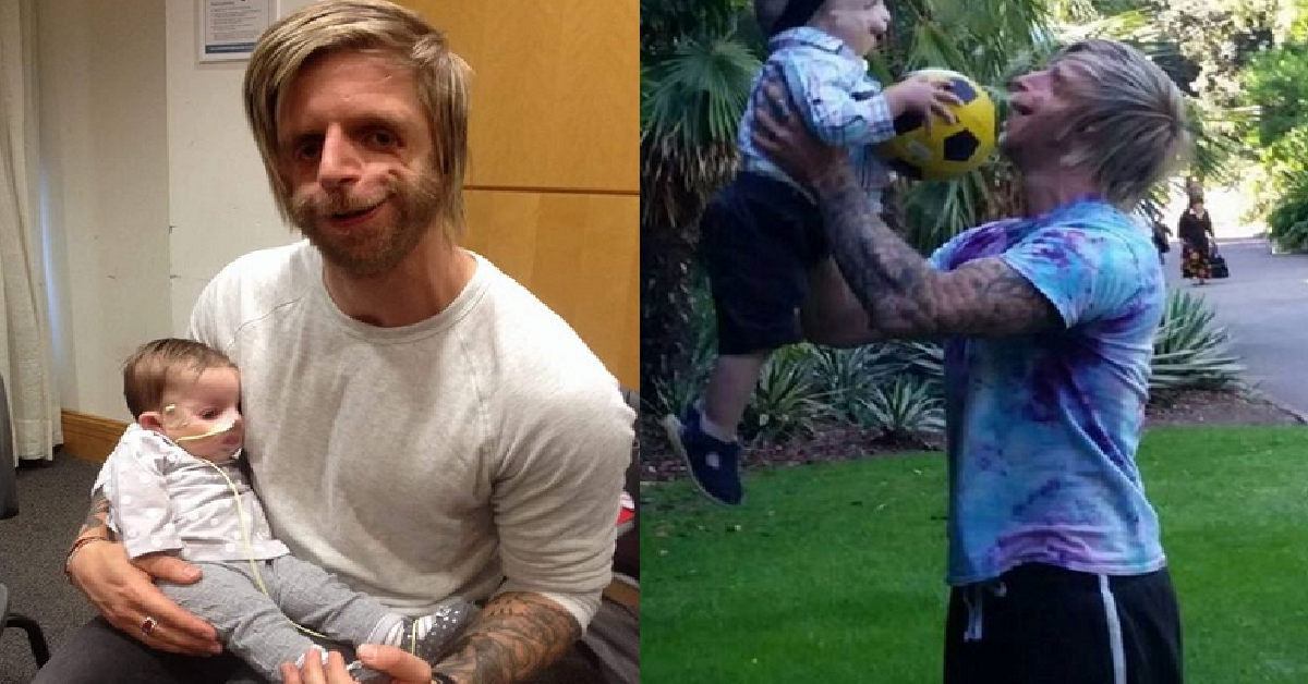 Man flies overseas to meet boy with the same rare disability