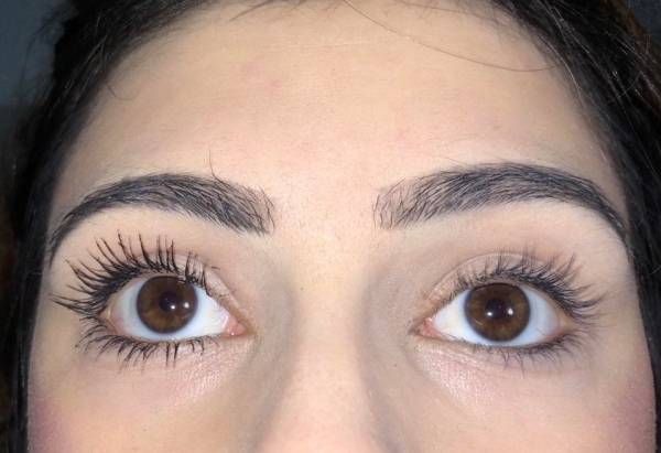 Cool Genetic Anomalies That Make People Stand Out