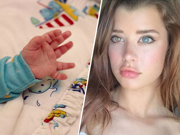 Cool Genetic Anomalies That Make People Stand Out