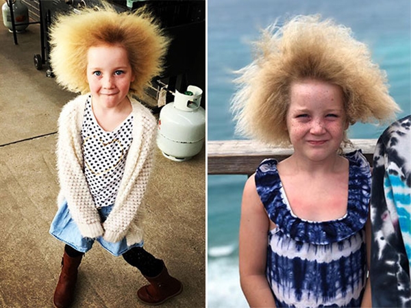 These people’s genetic anomalies will blow your mind (30 Photos)