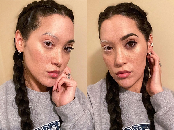 These people’s genetic anomalies will blow your mind (30 Photos)