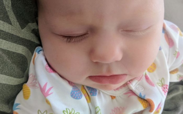 These people’s genetic anomalies will blow your mind (30 Photos)