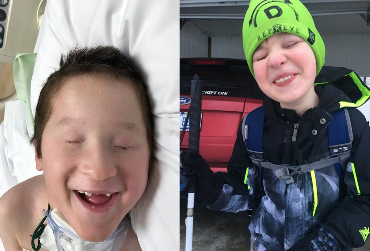 Born without eyes – Passing the torch from beyond the grave (22 Photos)