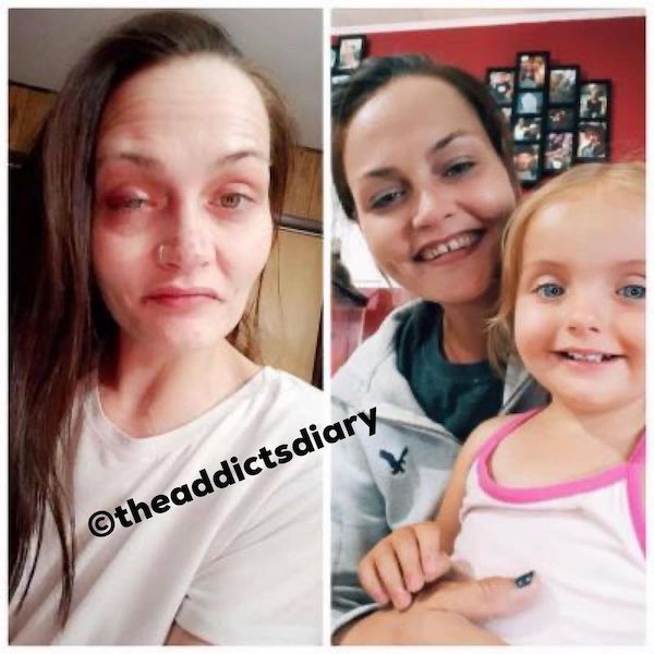 Inspiring Transformations Of Drug Addicts Before And After Addiction