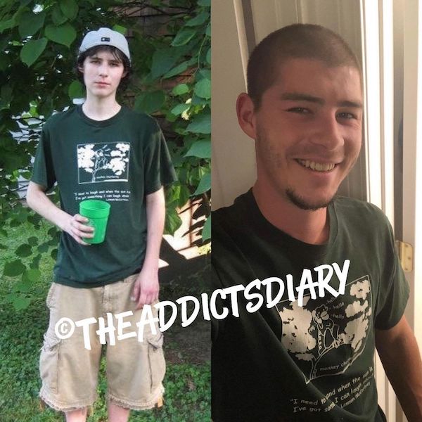Inspiring Transformations Of Drug Addicts Before And After Addiction