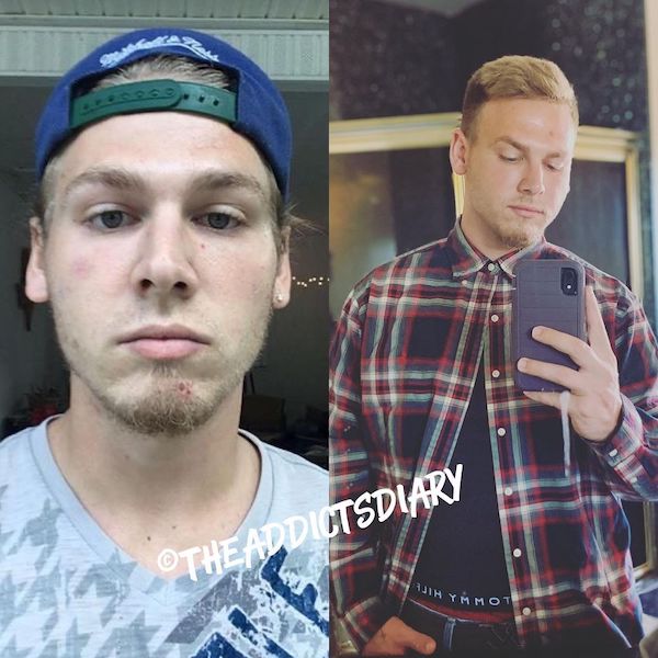 Inspiring Transformations Of Drug Addicts Before And After Addiction