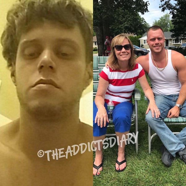 Inspiring Transformations Of Drug Addicts Before And After Addiction