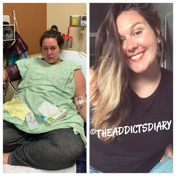 Inspiring Transformations Of Drug Addicts Before And After Addiction