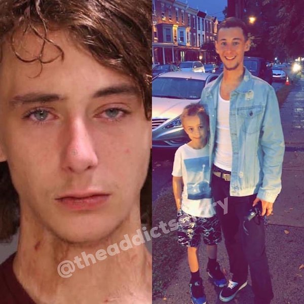 Inspiring Transformations Of Drug Addicts Before And After Addiction