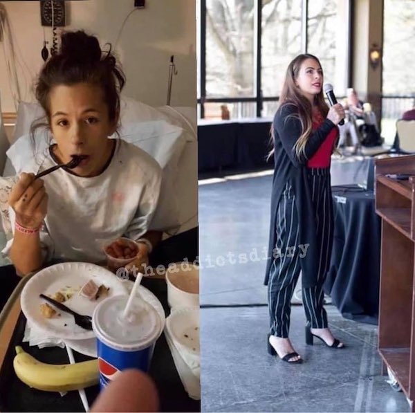 Inspiring Transformations Of Drug Addicts Before And After Addiction