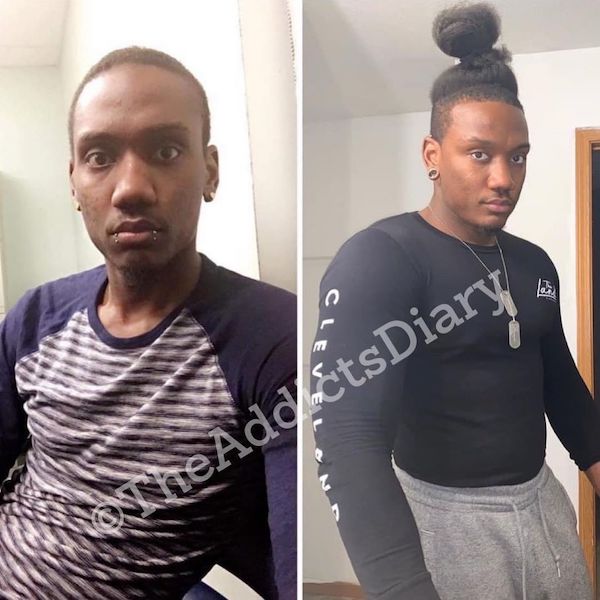 Inspiring Transformations Of Drug Addicts Before And After Addiction