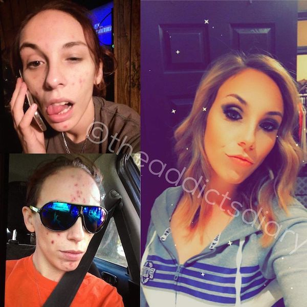 Inspiring Transformations Of Drug Addicts Before And After Addiction