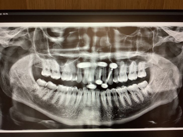 X-ray vision reveals incredible details that nature never could