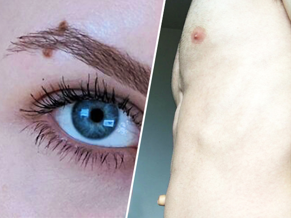 These people’s genetic anomalies will blow your mind (30 Photos)
