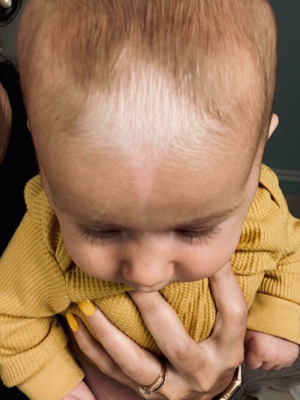 These people’s genetic anomalies will blow your mind (30 Photos)