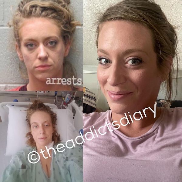 Inspiring Recoveries Of Drug Addicts Before Vs. After Getting Clean