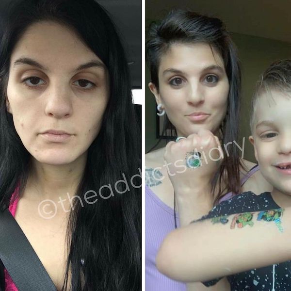 Amazing Before And After Photos Of Recovering Drug Addicts