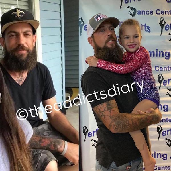 Amazing Before And After Photos Of Recovering Drug Addicts