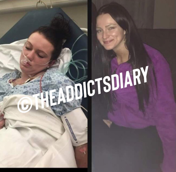 Inspiring Recovered Drug Addicts Share Their Stories