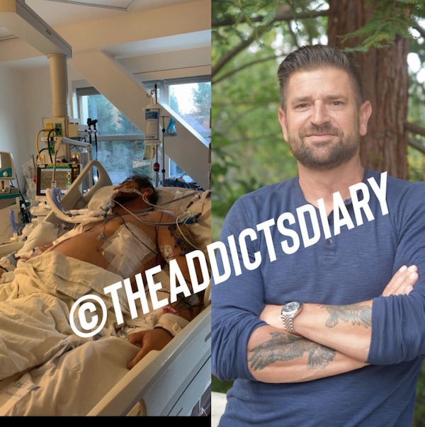 Inspiring Recovered Drug Addicts Share Their Stories