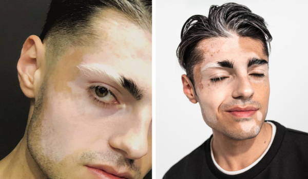 These Rare Mutations Are Simply Beautiful