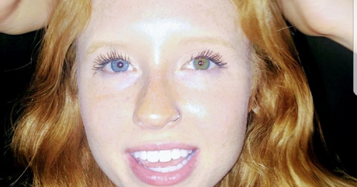 These Rare Mutations Are Simply Beautiful