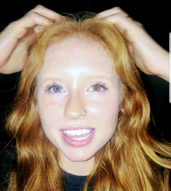 Amazing Genetic Mutations