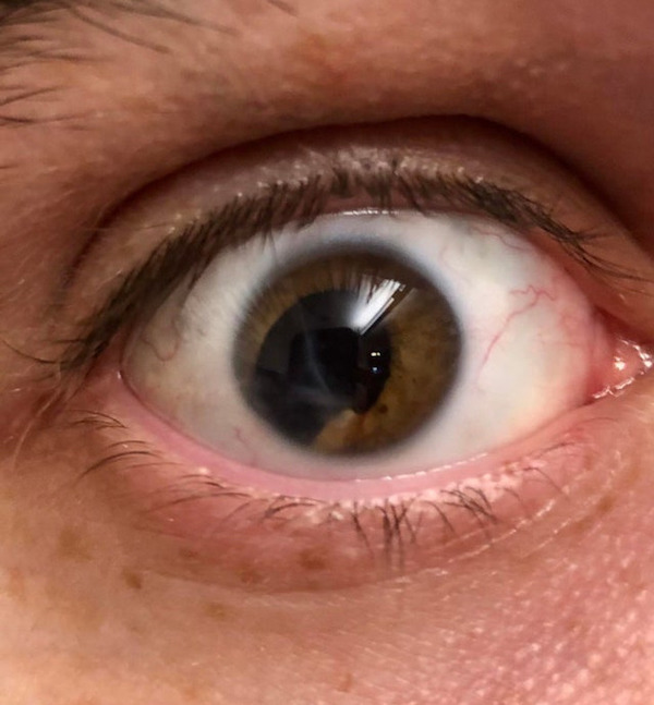 Physical mutations that prove we're all one of a kind | theCHIVE