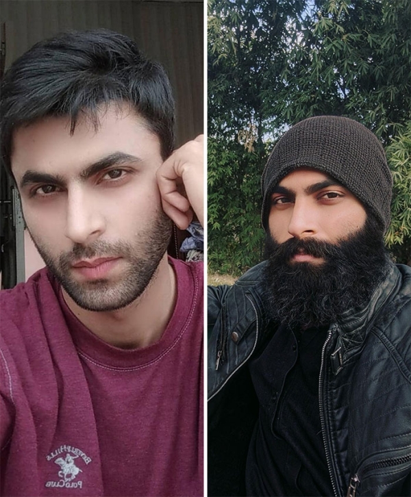 INSANE before and after beard transformations (32 Photos)