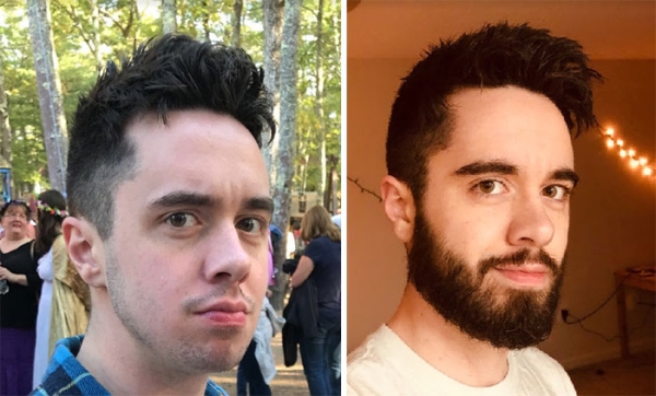INSANE before and after beard transformations (32 Photos)