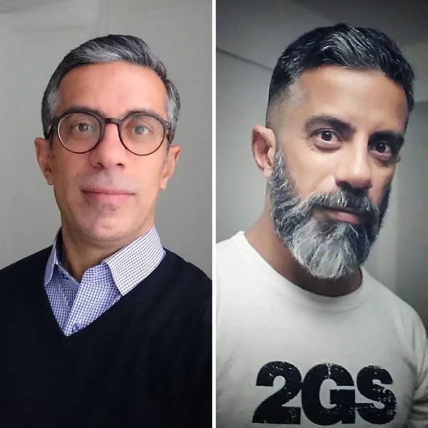 INSANE before and after beard transformations (32 Photos)
