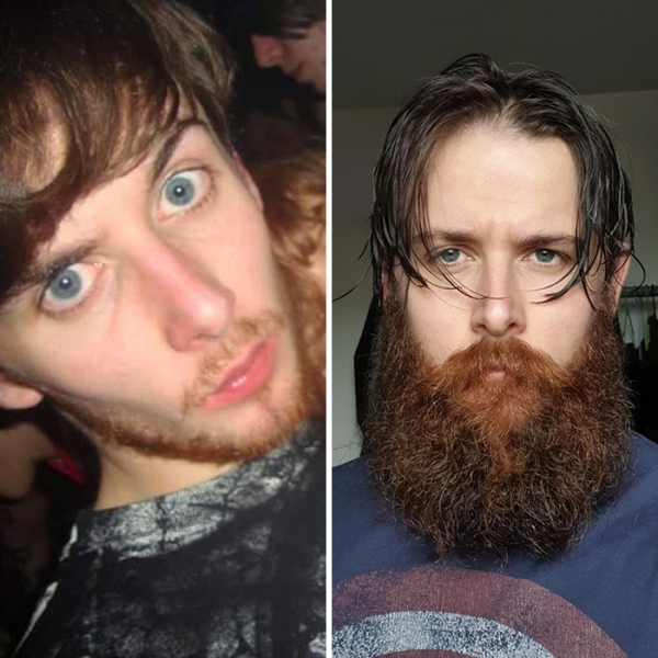 INSANE before and after beard transformations (32 Photos)