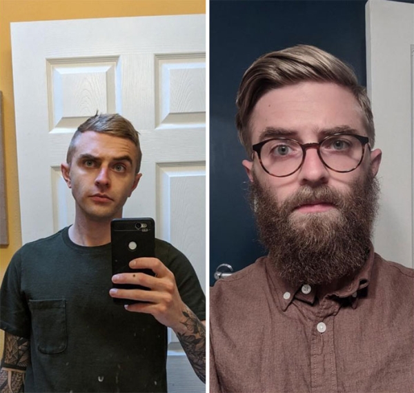 INSANE before and after beard transformations (32 Photos)
