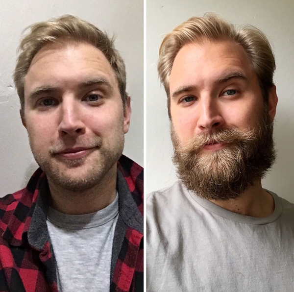 INSANE before and after beard transformations (32 Photos)