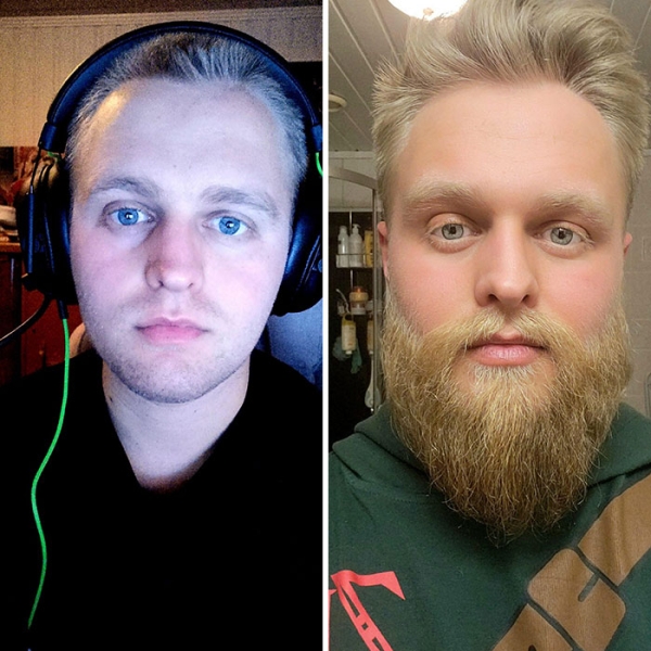 INSANE before and after beard transformations (32 Photos)