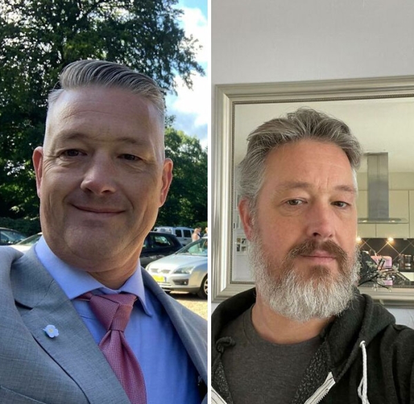 INSANE before and after beard transformations (32 Photos)