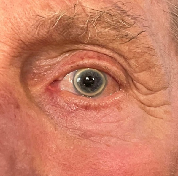 These Rare Mutations Are Simply Beautiful