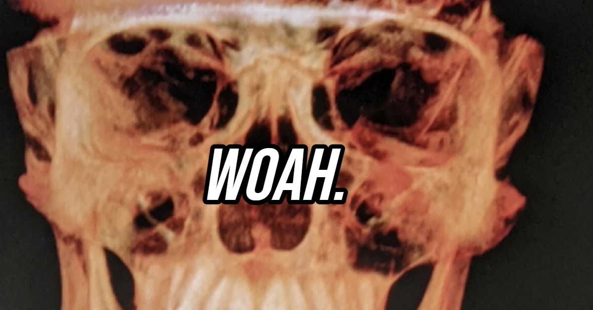 Woah, You Don’t See That Every Day!