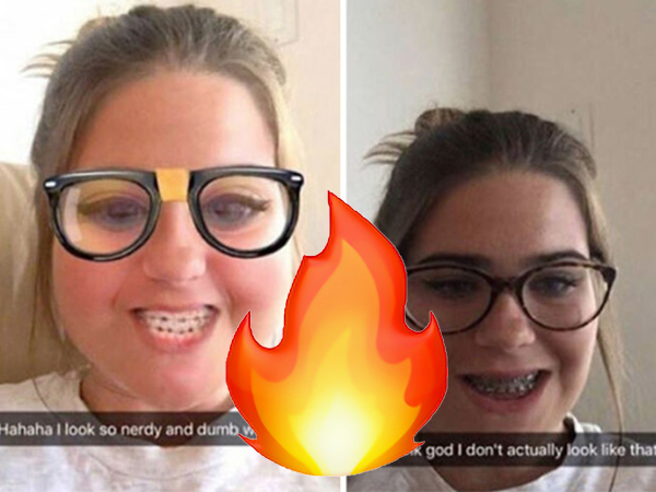 Ooh...self-burn, those are rare (28 Photos)