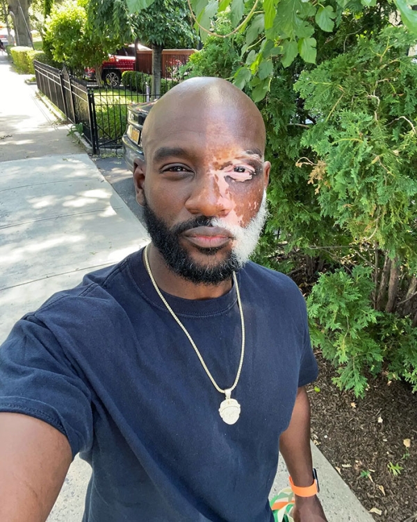 These people’s genetic anomalies will blow your mind (30 Photos)