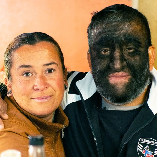 These people’s genetic anomalies will blow your mind (30 Photos)