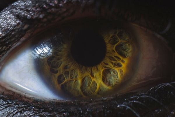 These people’s genetic anomalies will blow your mind (30 Photos)