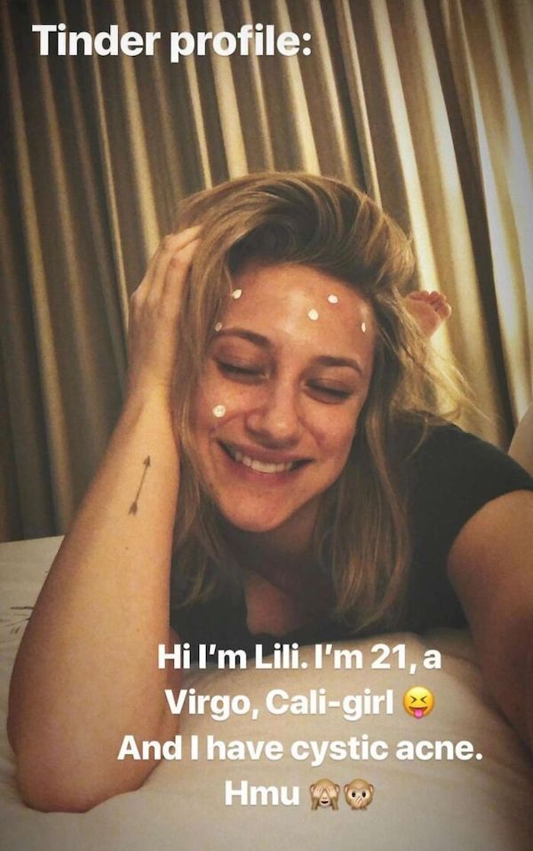 These celebs ditched the makeup & filters to show their natural beauty
