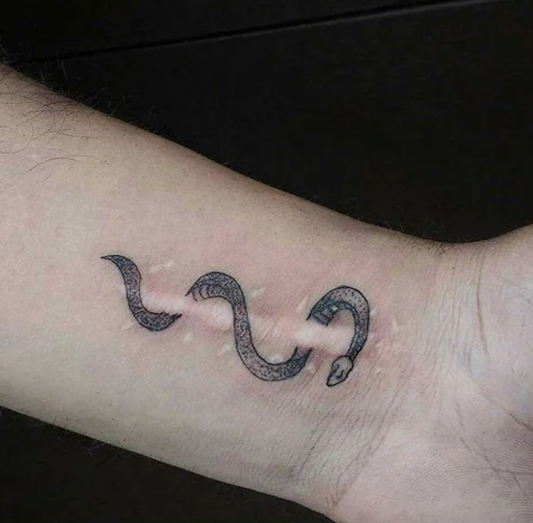 Scars transformed into clever works of art