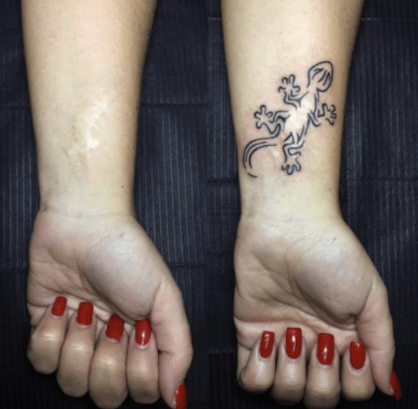 Scars transformed into clever works of art