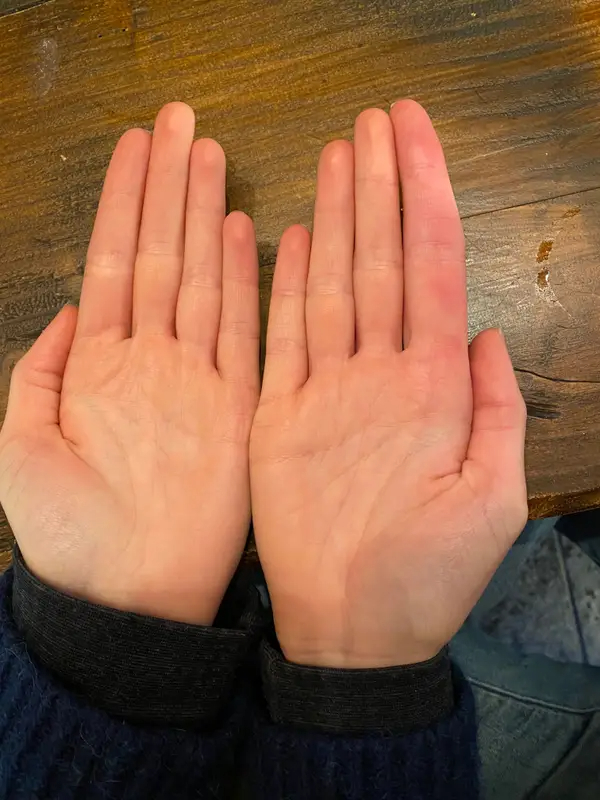 Unique and Amazing Body Abnormalities
