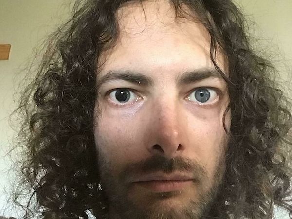 These people’s genetic anomalies will blow your mind (30 Photos)