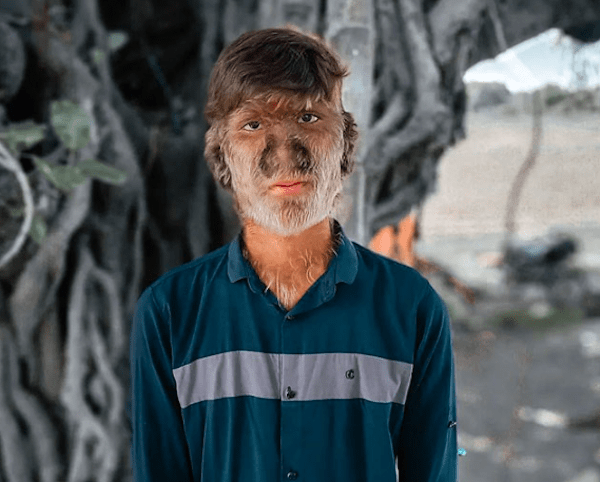 These people’s genetic anomalies will blow your mind (30 Photos)