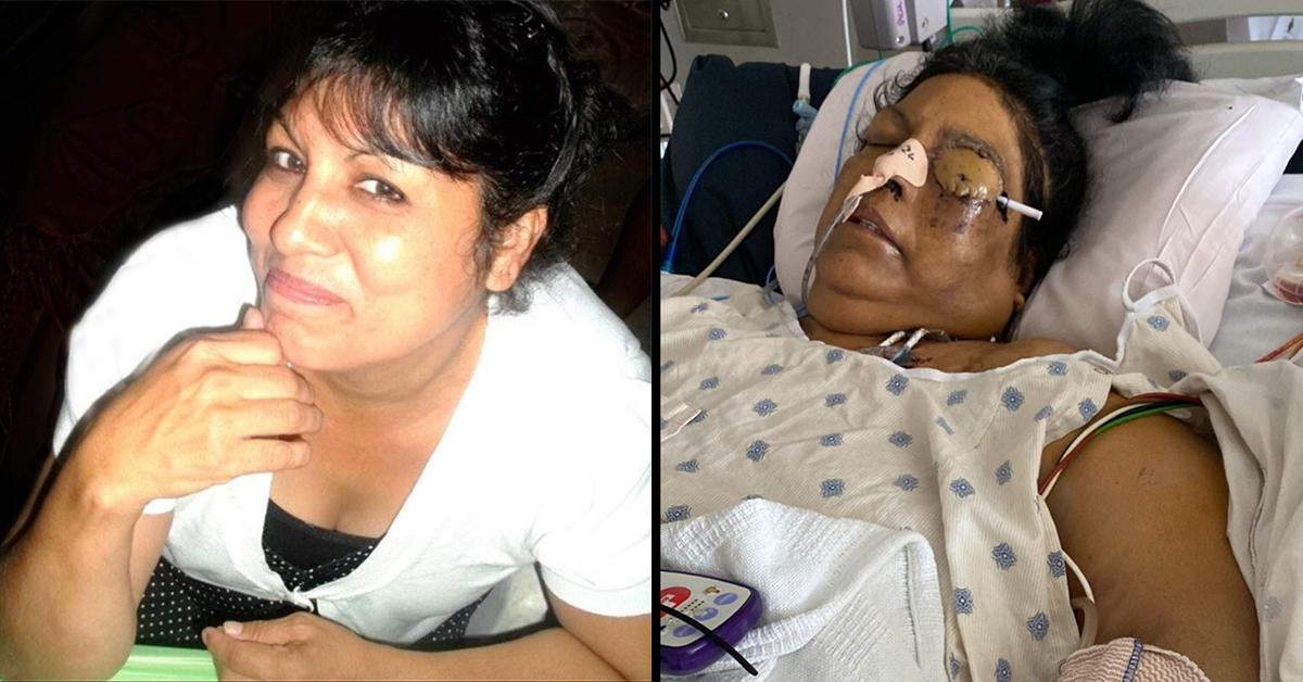 Life for Mary changed in an instant. See how Chive Charities helped.