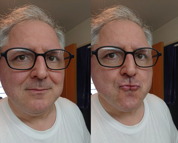 People embracing their genetic abnormalities are beautiful